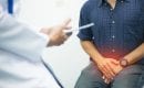 ¿Cuánto cuesta una Cirugía de Varicocele en México? | Dr. Patricio Cruz